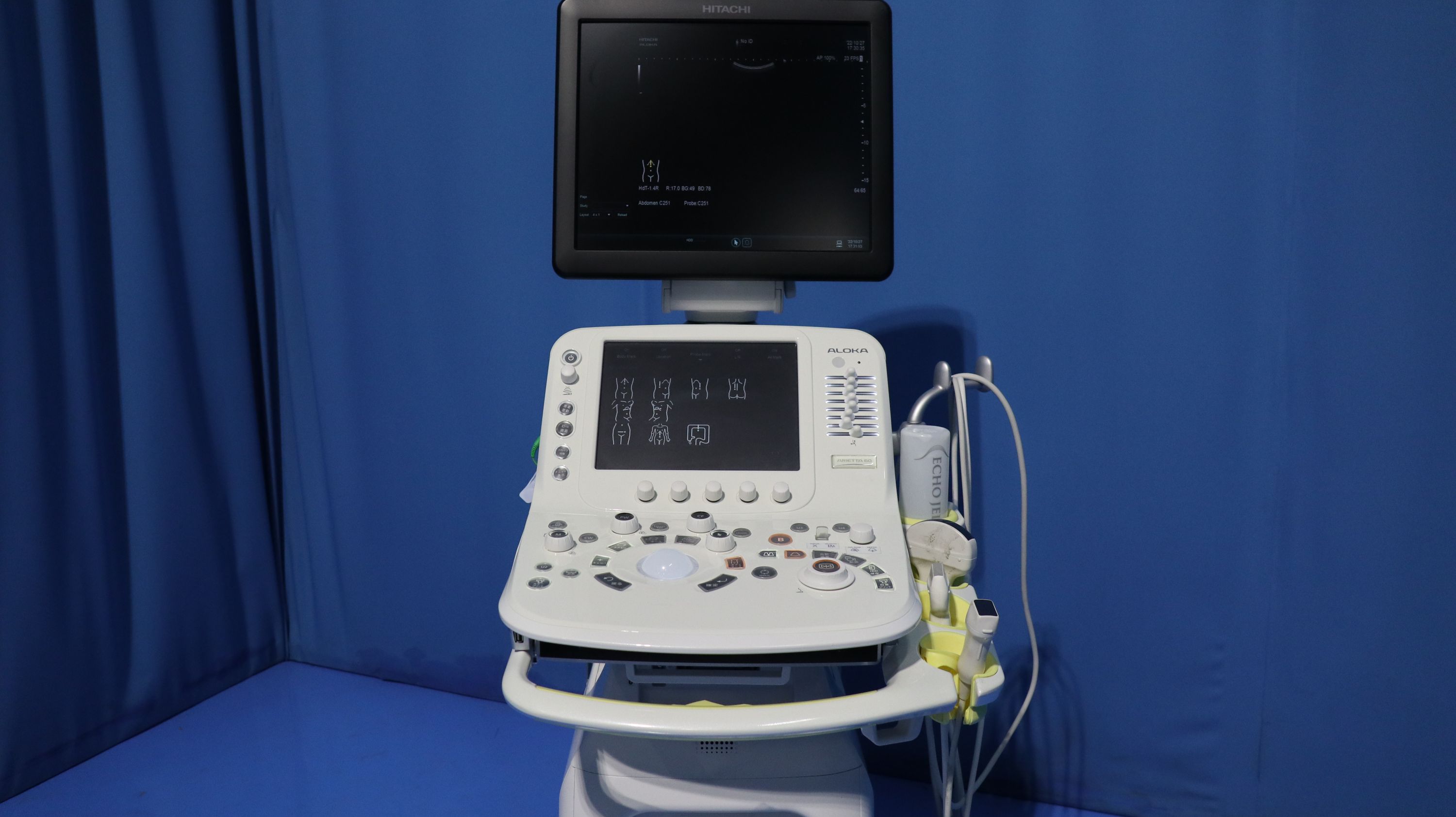 Product detail｜14407｜HITACHI｜Not Found｜ARIETTA 60｜Fair Medical Co Ltd ...