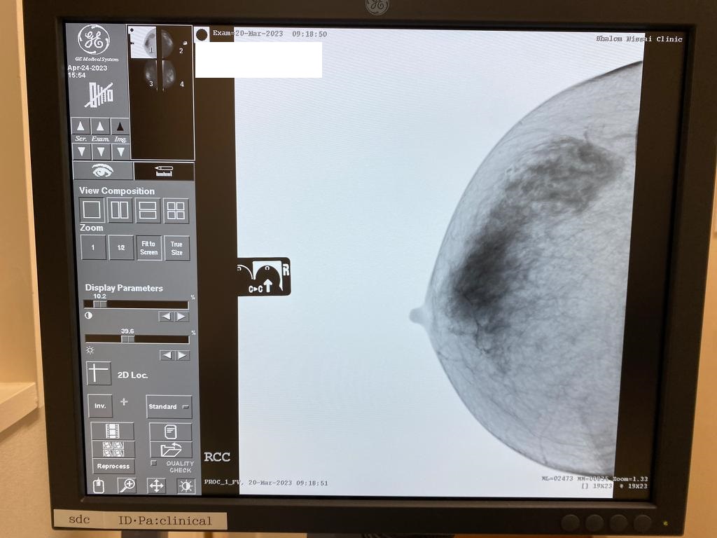 Product detail｜15038｜GE｜Not Found｜Senographe DS｜Fair Medical Co Ltd. Japan