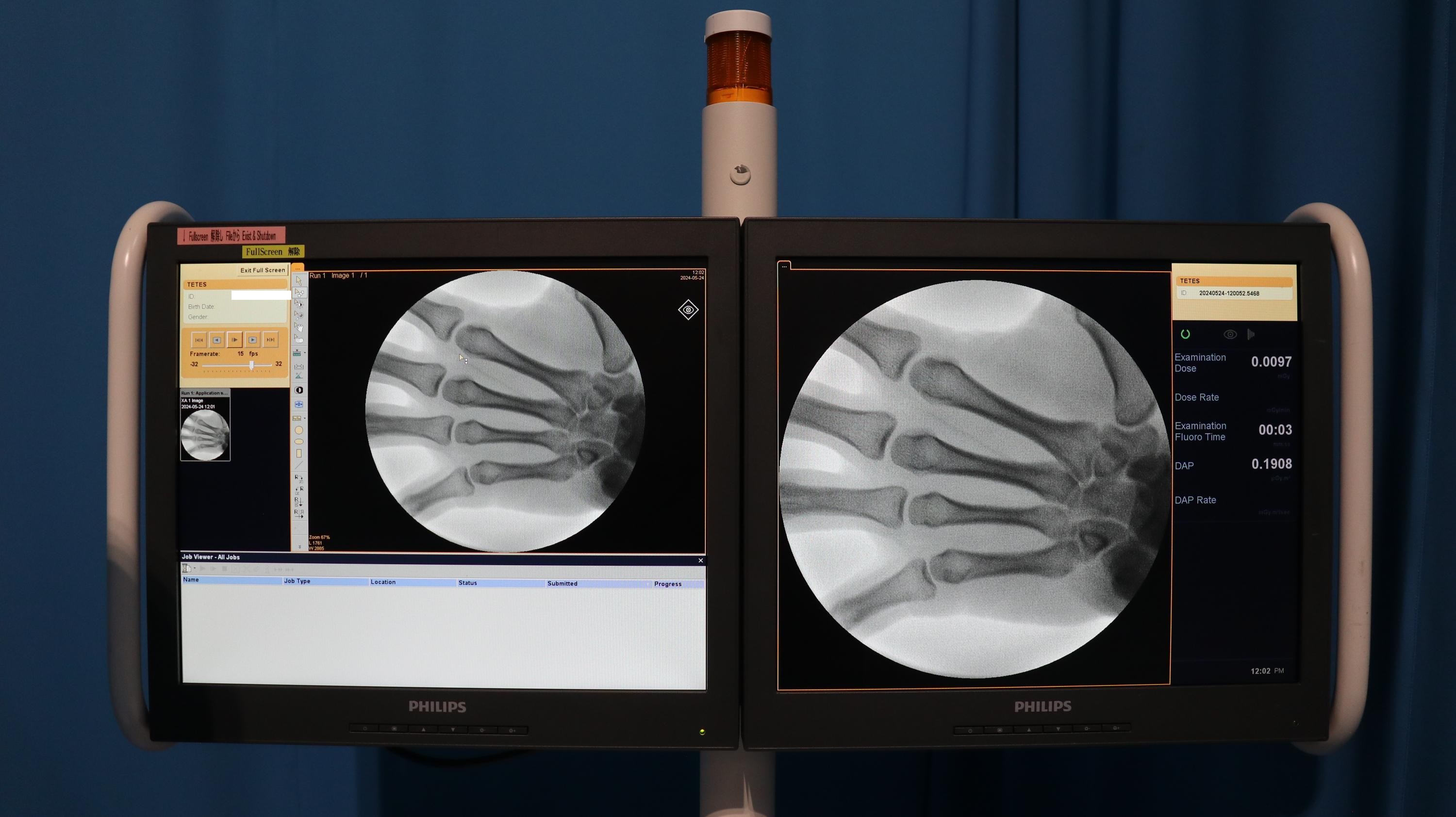 Product detail｜15947｜PHILIPS｜Not Found｜Vectra｜Fair Medical Co Ltd. Japan