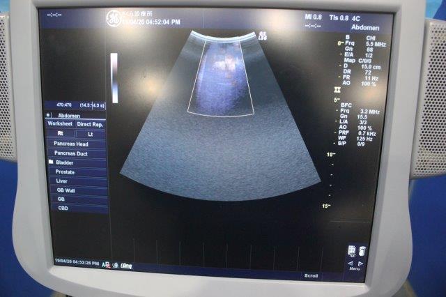 Product detail｜2641｜GE｜The ultrasonic diagnostic apparatus｜LOGIQ S6 ...